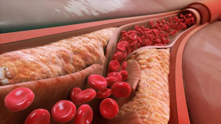 VASCULAR CONDITIONS – Dr Marek Sepiolo